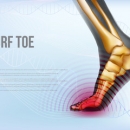 04/12/2022 7 – 9 PM CT Athletic Injuries 308: Football Injuries – Turf Toe